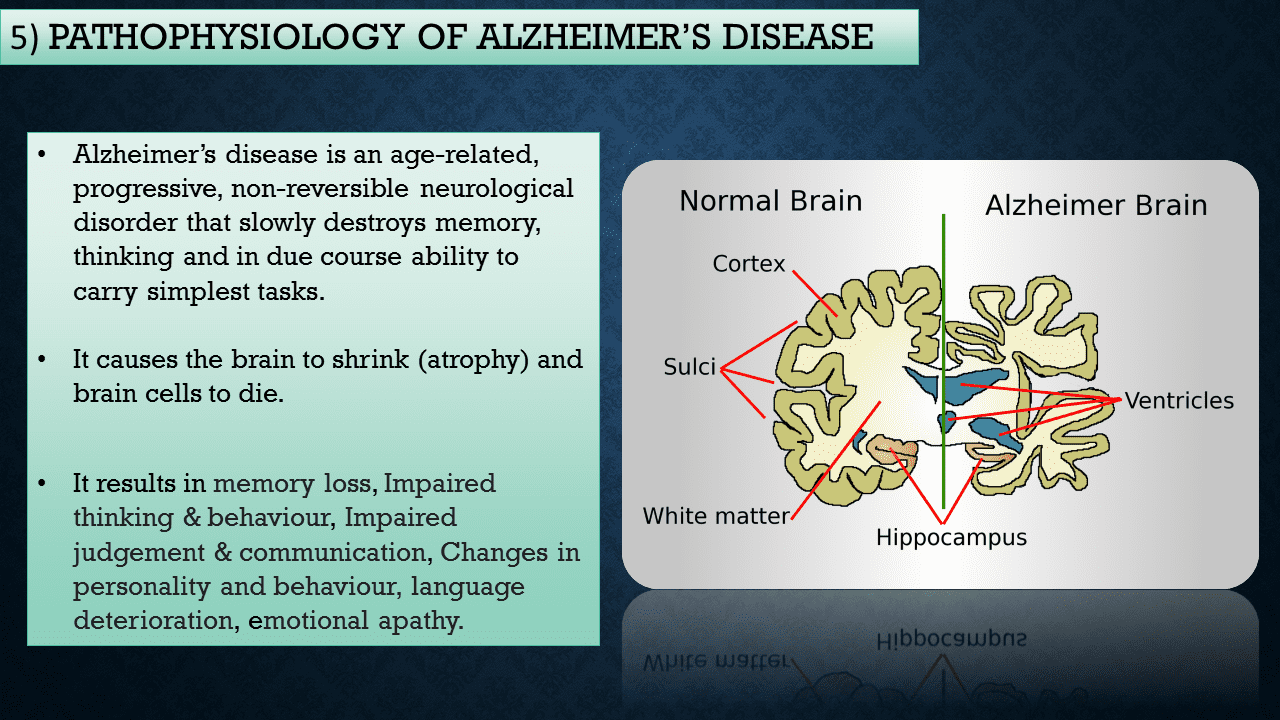 Neurology Pathophysiology Pictorial Presentation - NeuroHealth