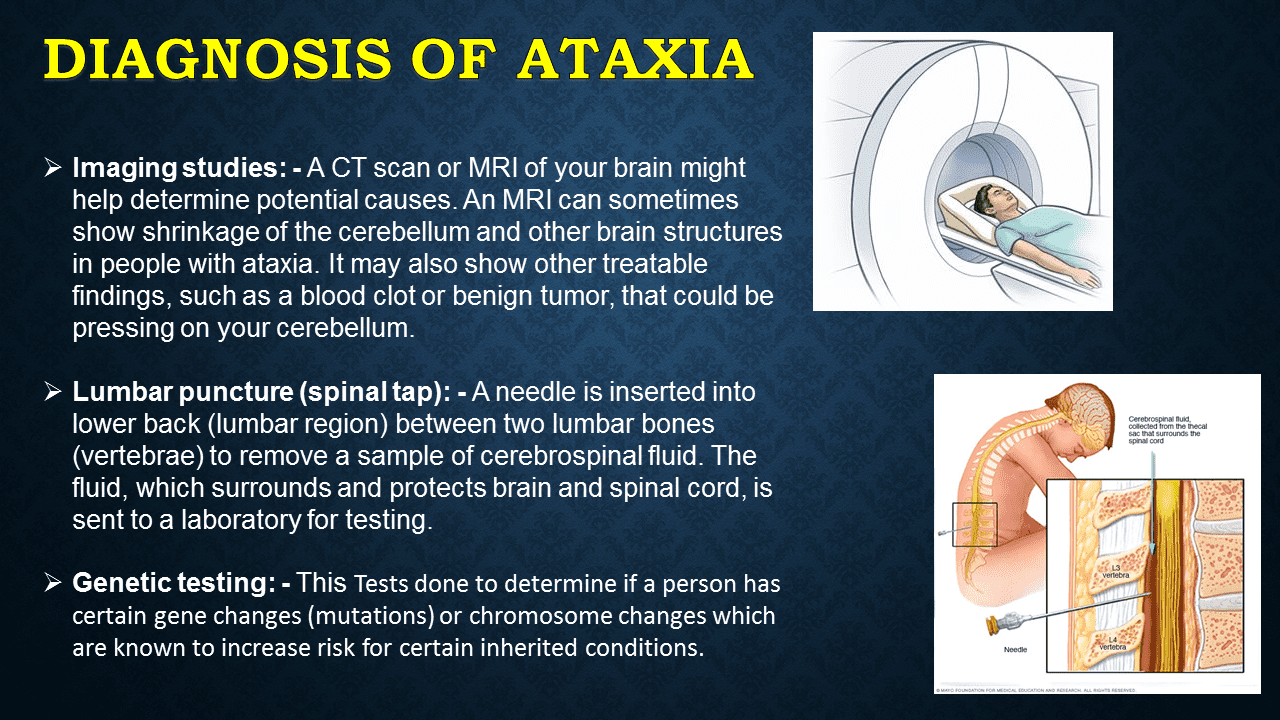 Neurological Disorder: Ataxia Pictorial Presentation - NeuroHealth