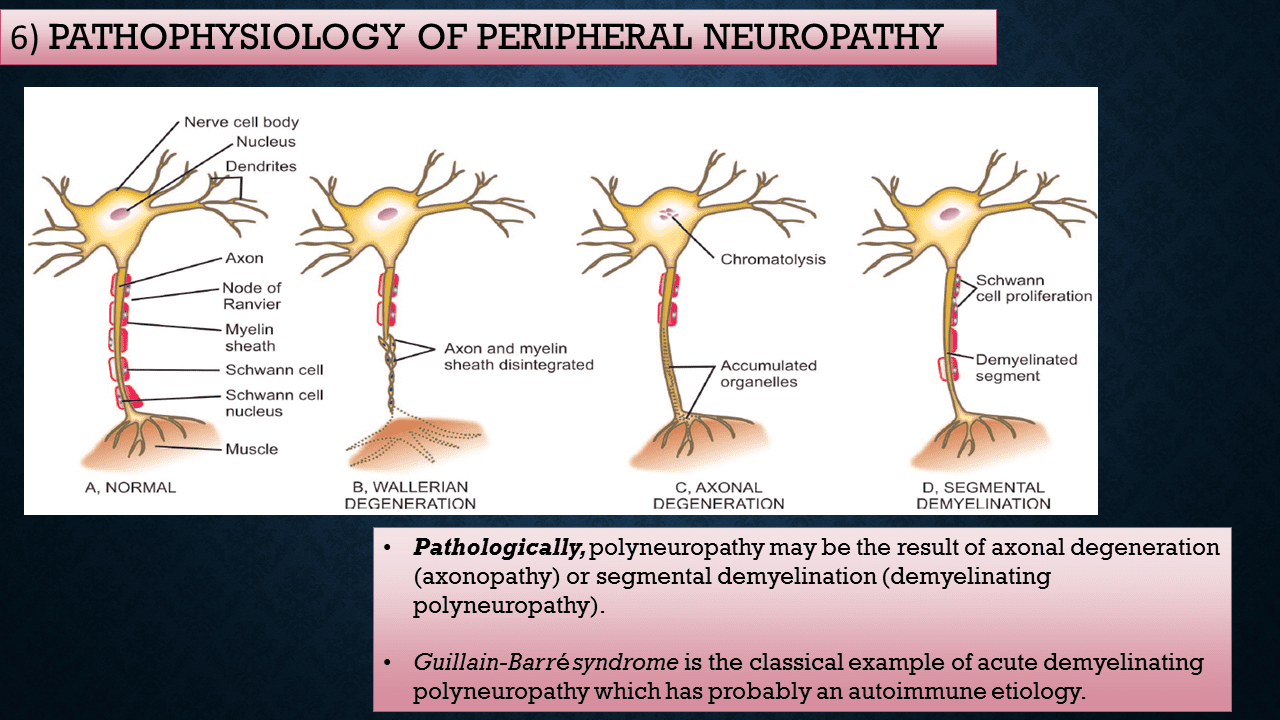 Neurology Pathophysiology Pictorial Presentation - NeuroHealth