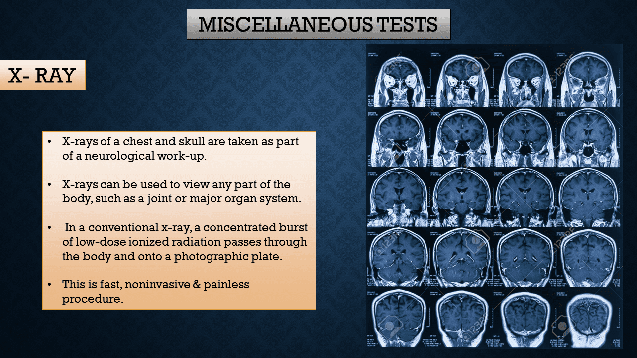 Neurology Diagnostic Tests Pictorial Presentation - NeuroHealth