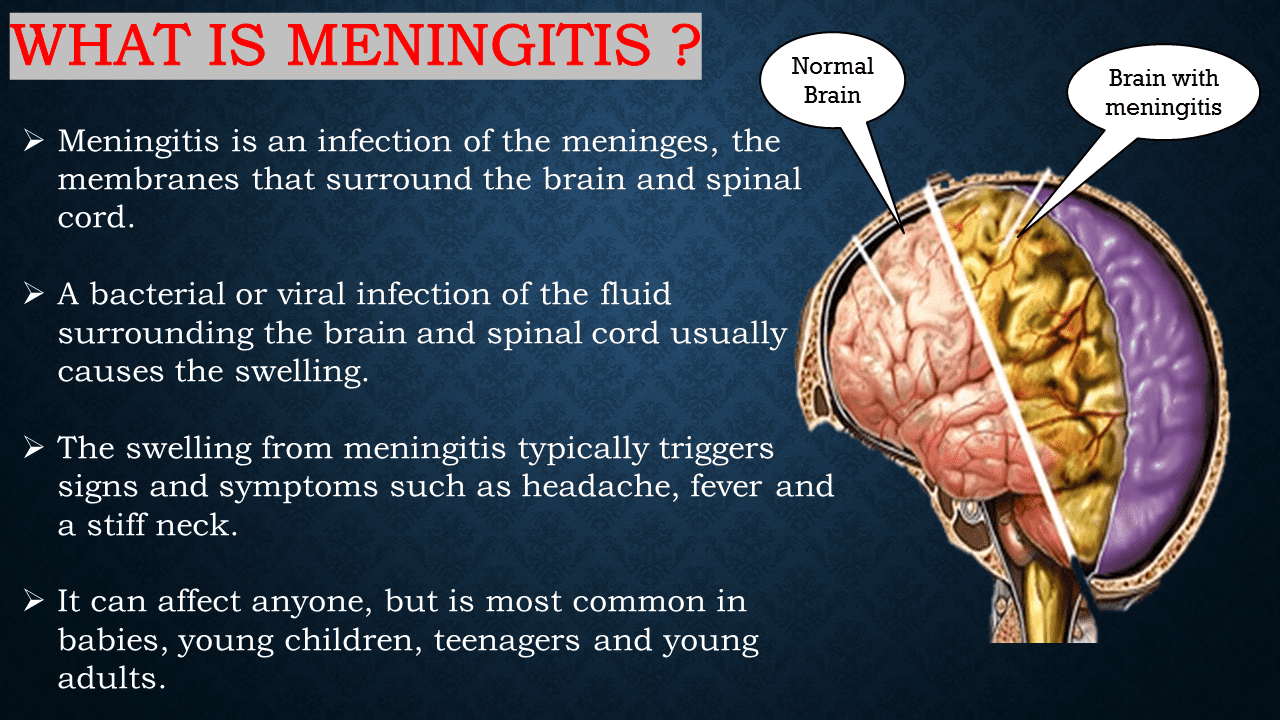 Meningitis Pictorial Presentation - NeuroHealth