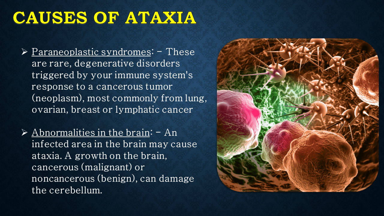 Neurological Disorder: Ataxia Pictorial Presentation - NeuroHealth
