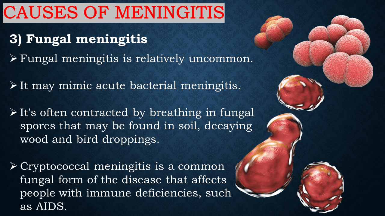 Meningitis Pictorial Presentation - NeuroHealth
