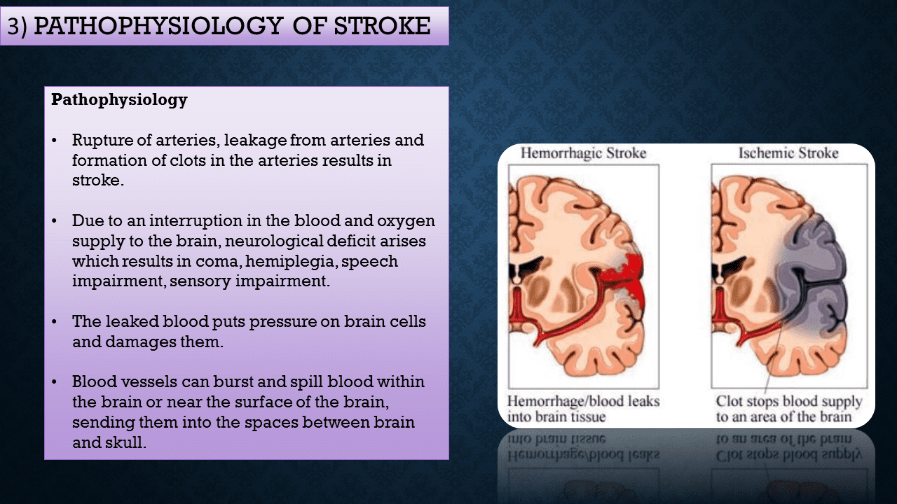Neurology Pathophysiology Pictorial Presentation - NeuroHealth