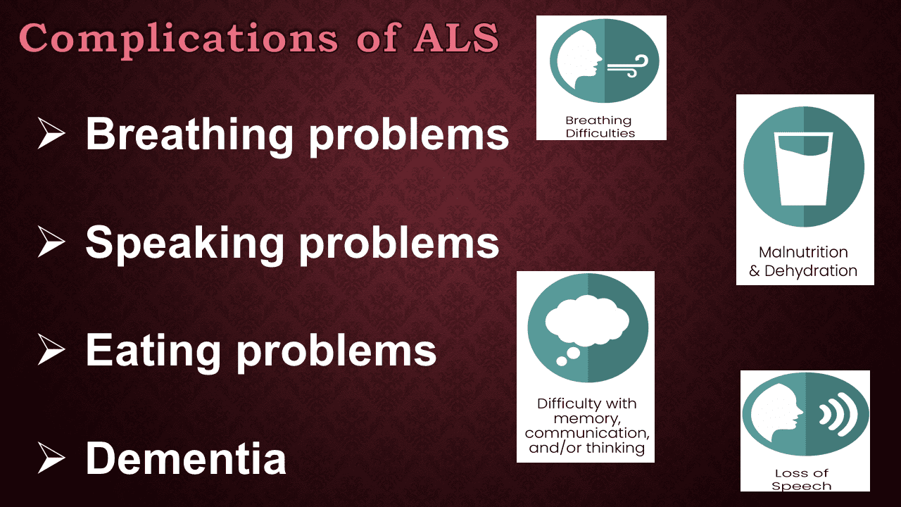Amyotrophic lateral sclerosis (ALS) Pictorial Presentation - NeuroHealth